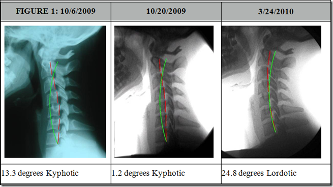 American Journal of Clinical Chiropractic - Chiropractic BioPhysics ...